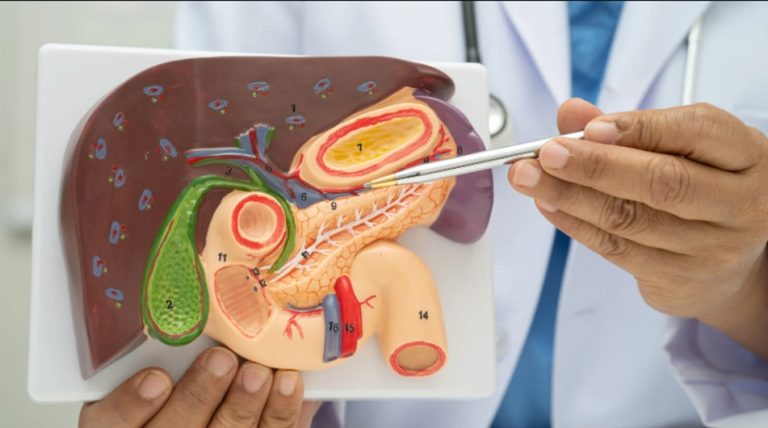 Gallbladder Removal and Weight Management: What’s the Connection? - UP ...